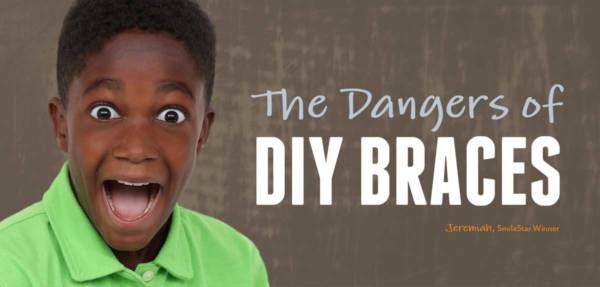 DIY Braces: Are They Safe? | Homemade Braces | Kelley Orthodontics