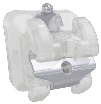 Metal & Clear Braces | Kelley Orthodontics | Damon System