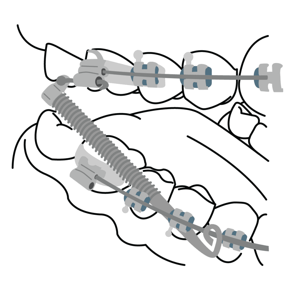 Orthodontic Appliance Art